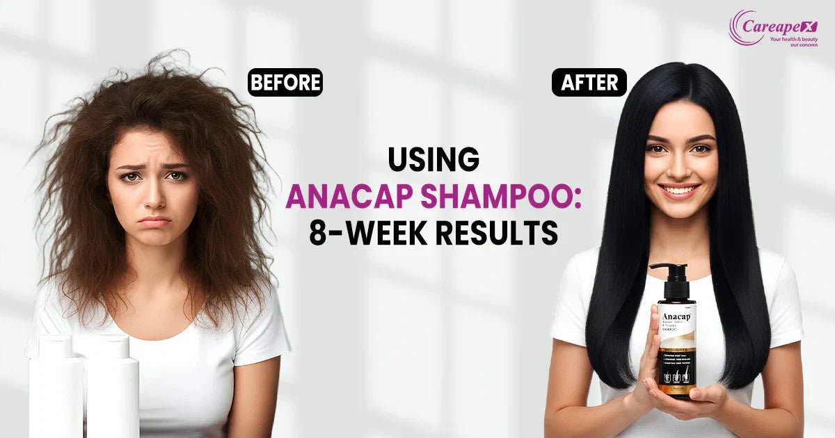 Anacap shampoo 8-Week Results & Before/After – CareApex